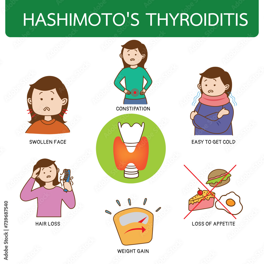 Hashimoto's thyroiditis symptom, illustration cartoon on white ...