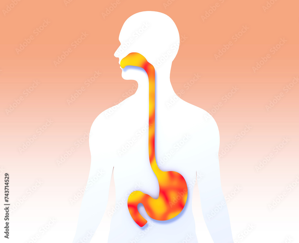 3d illustration of stomach and esophagus to the mouth with fire ...
