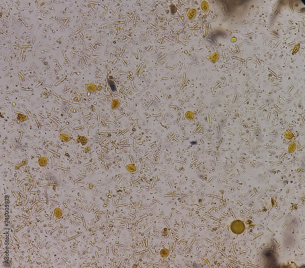 Fotografie Giardia lamblia cysts and Trophozoite form, muscle fiber in ...