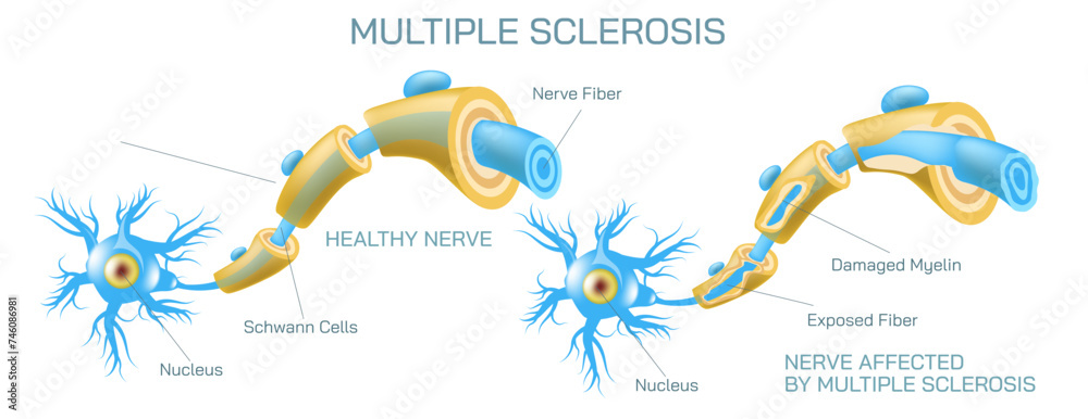 how neurotransmitter works? The process the brain neurons communicate each other anatomy vector ...