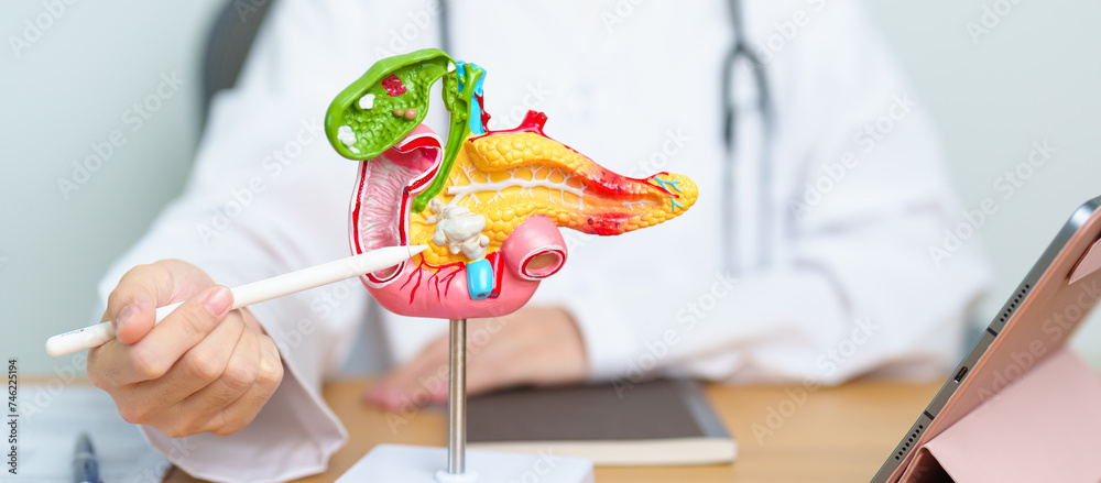 Doctor with human Pancreatitis anatomy model with Pancreas, Gallbladder ...