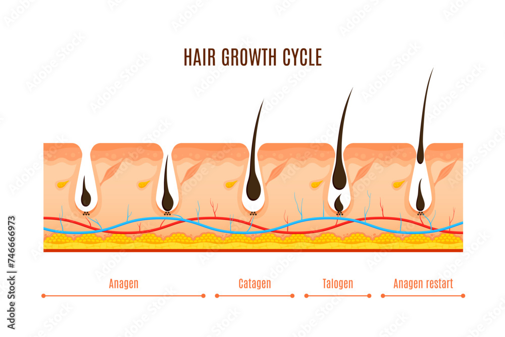 Hair growth cycle phases vector cross section infographics. Anagen ...