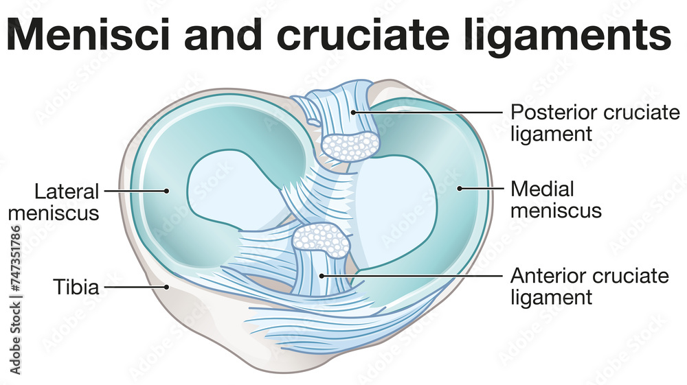 Menisci and cruciate ligaments anatomy. Labeled illustration Stock ...