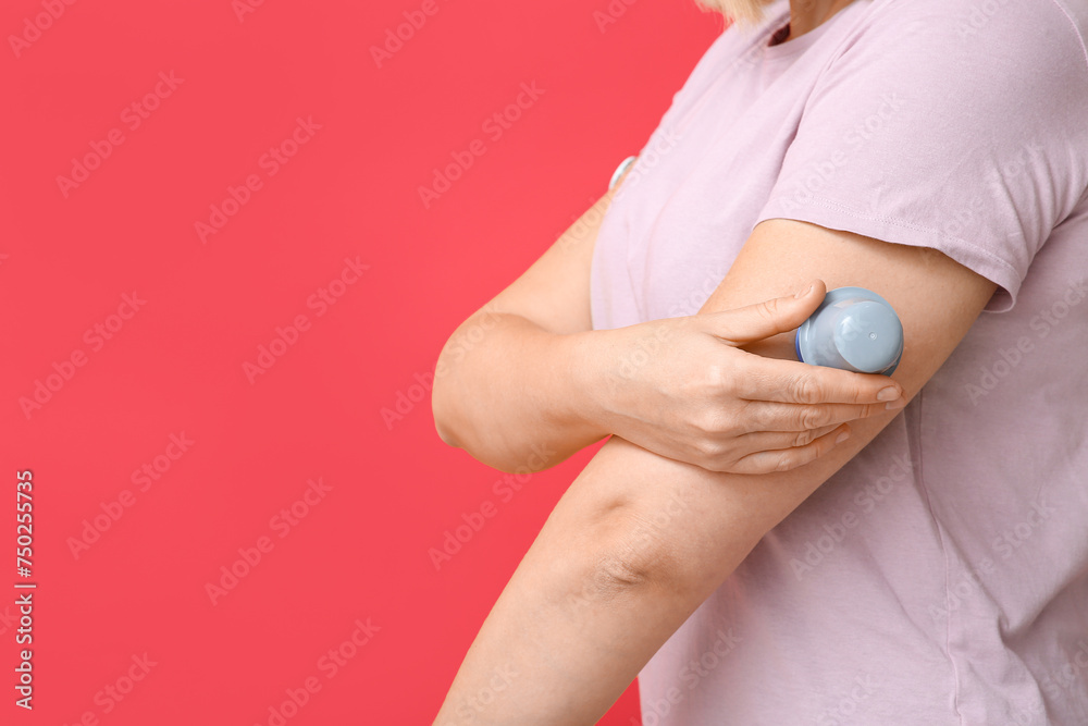 Woman with glucose sensor for measuring blood sugar level and ...