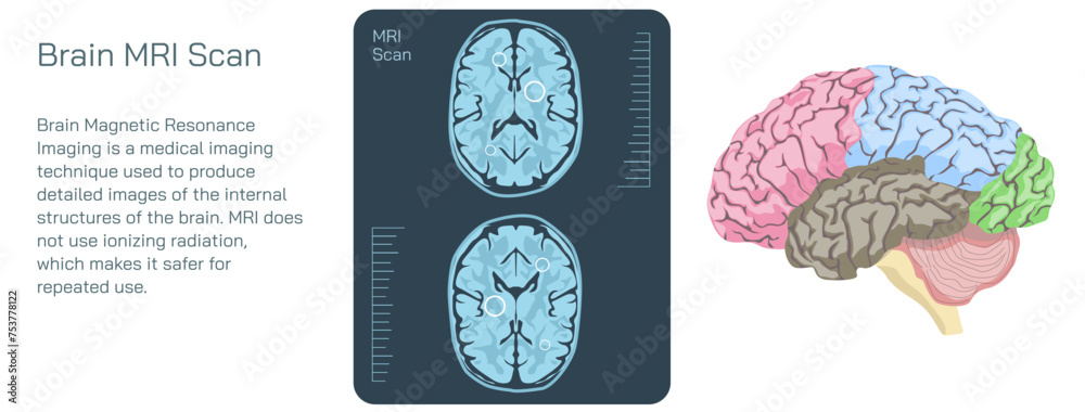 Brain MRI scan vector illustration. Magnetic resonance imaging is a ...