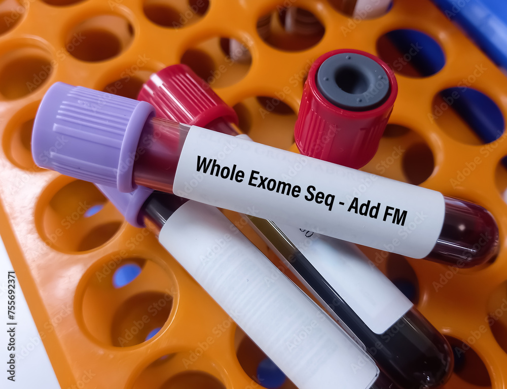 Blood sample for Whole Exome Sequencing Comparator - Additional FM test ...