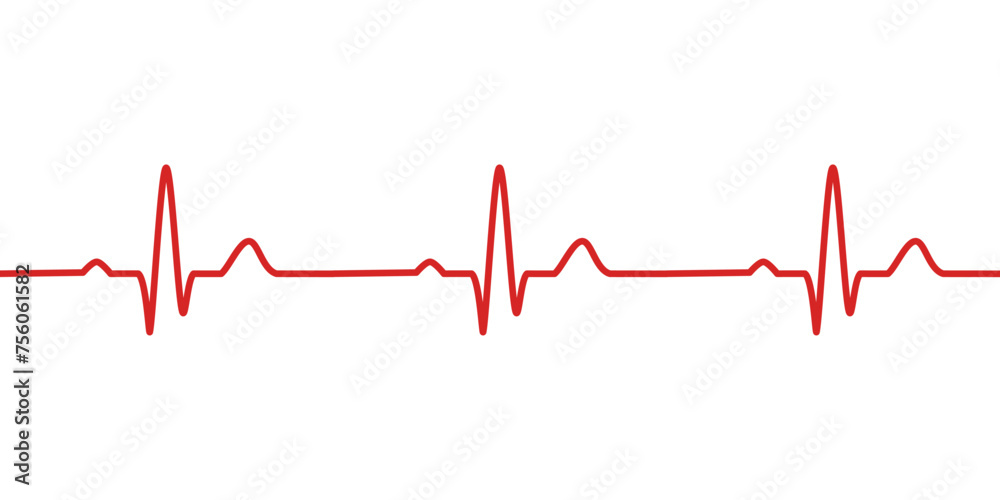 Red line of normal sinus rhythm from Electrocardiogram(EKG) heart graph. Vital Sign. Vector ...
