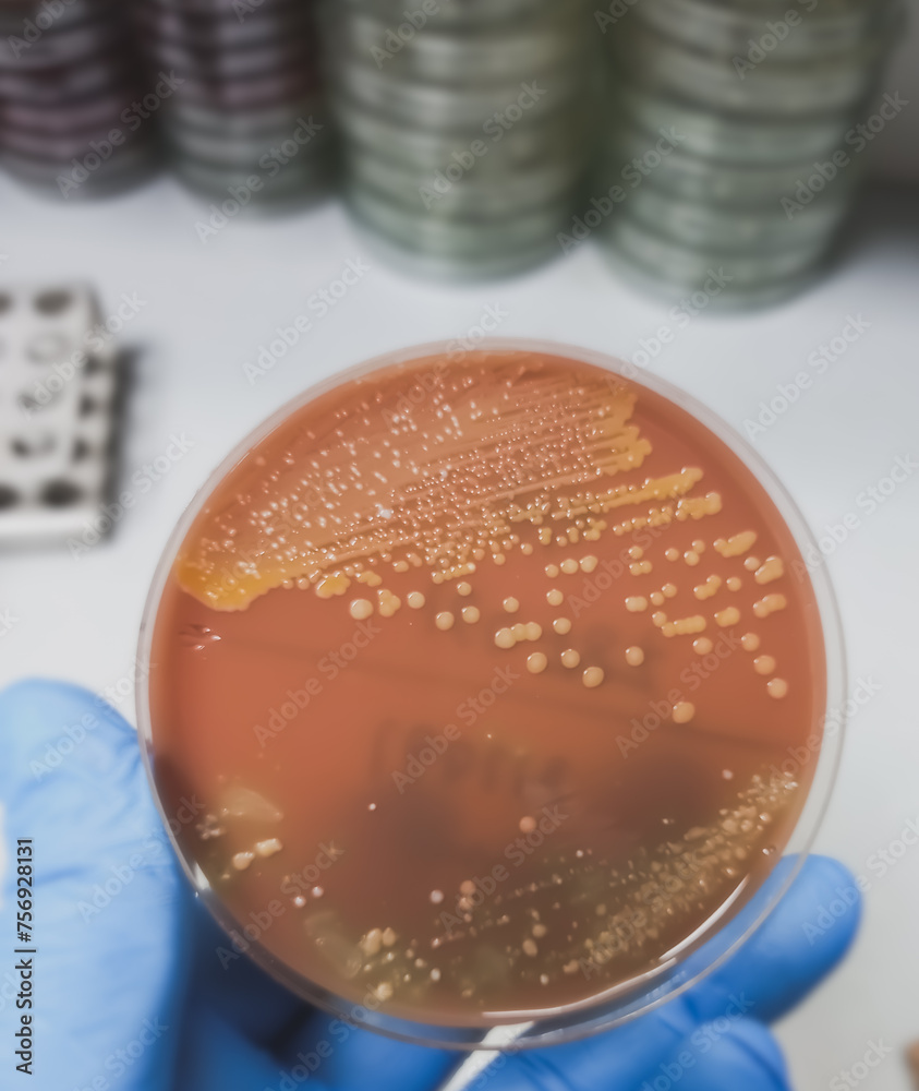 Golden color colonies on chocolate agar medium, growth of ...