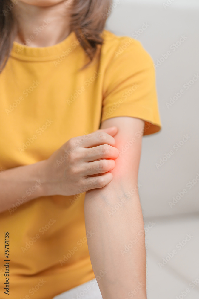 Stock-Foto „woman itching and scratching itchy arm. Sensitive Skin ...