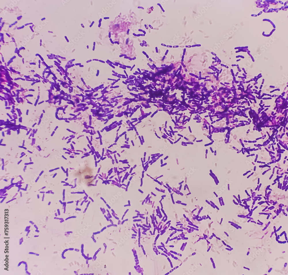 Yeast Infection; Budding yeast and pseudohyphae of Candida albicans, gram's stain. This fungus ...