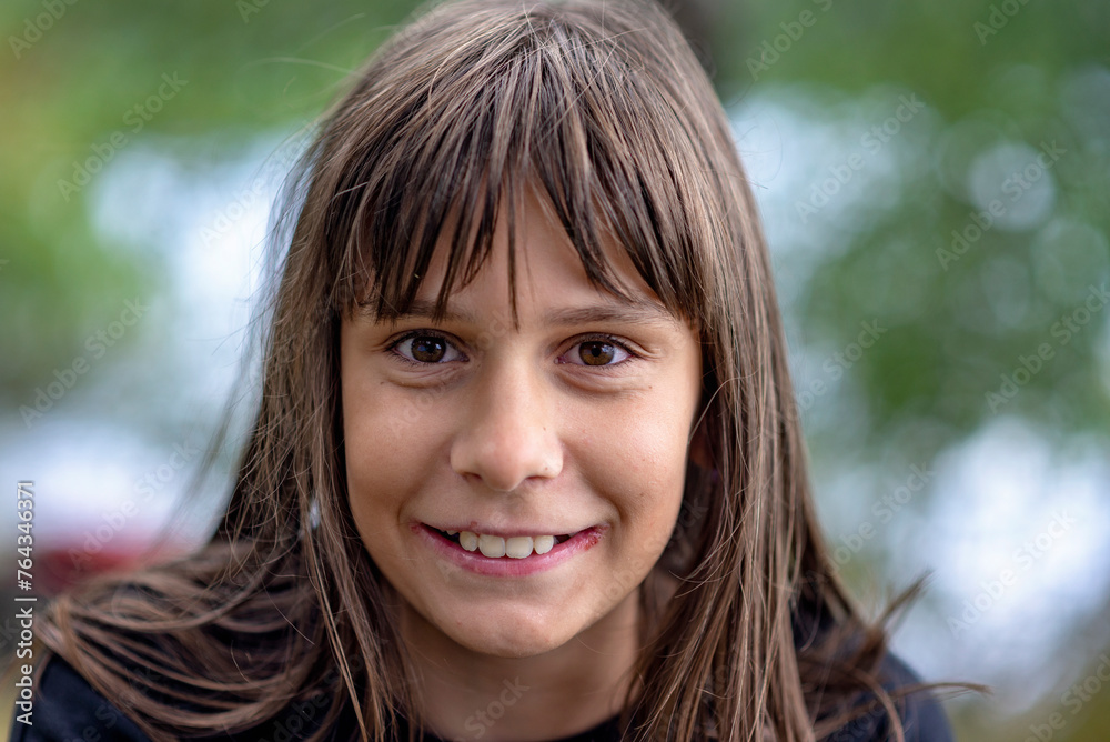 close up portrait of a cheerful girl's face, redness and inflammation ...