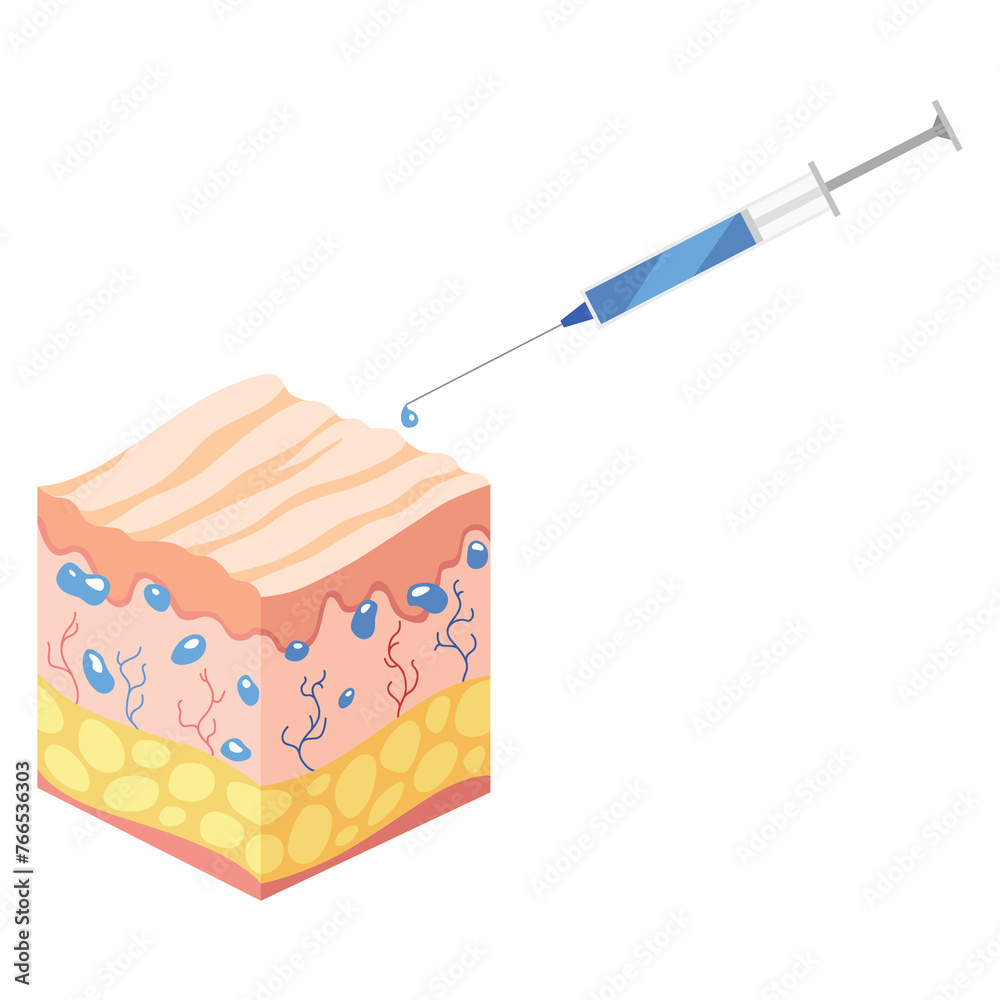 Hyaluronic acid isometric. Profile view cube representing skin ...