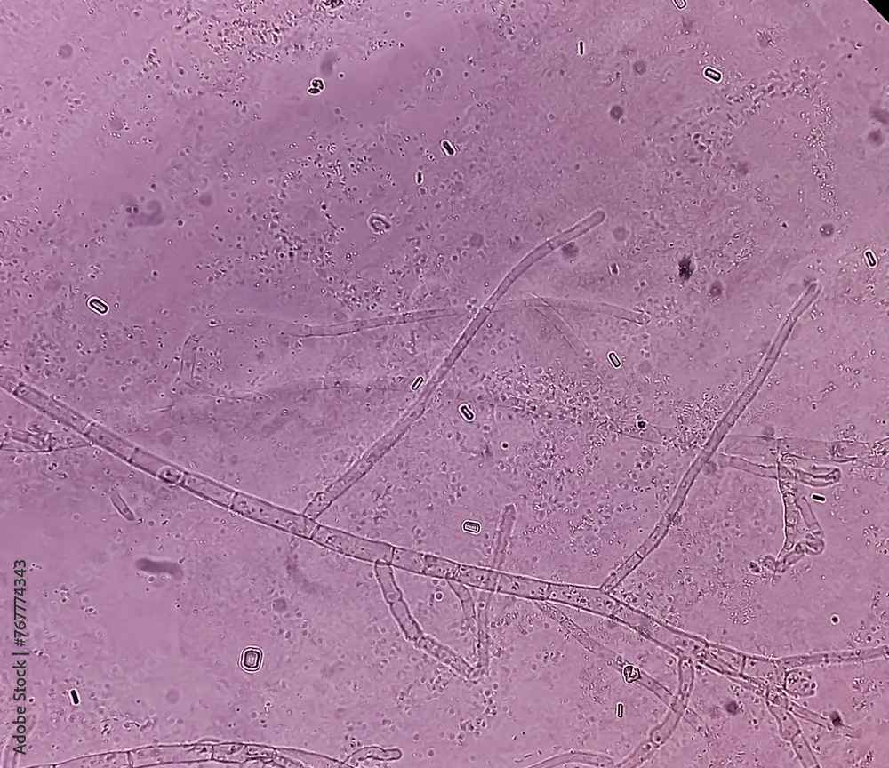 Microscopic image from fungus colonies at Sabouraud Dextrose Agar (SDA ...