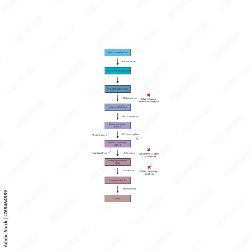 Diagram of porphyrin metabolism - showing enzyme deficiencies in the ...