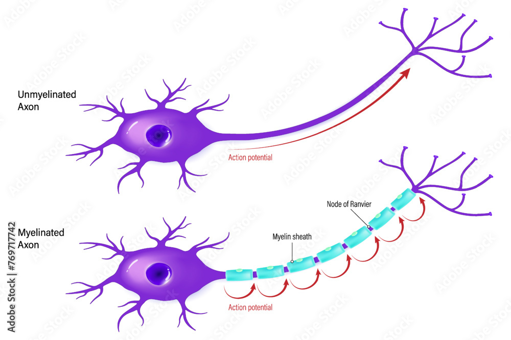 Difference between continuous conduction and saltatory conduction ...