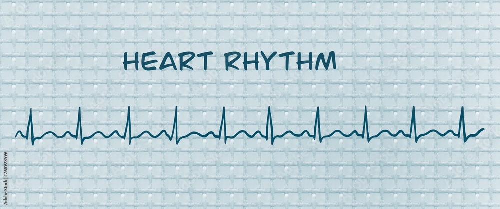 Ecg image shows normal sinüs rhythm Stock Illustration | Adobe Stock