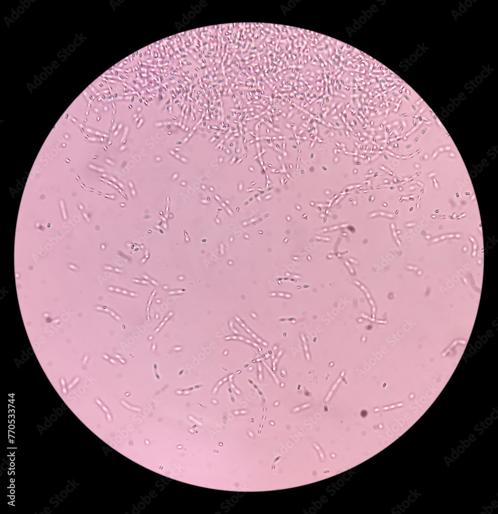 Microscopic image from fungus colonies at Sabouraud Dextrose Agar (SDA ...