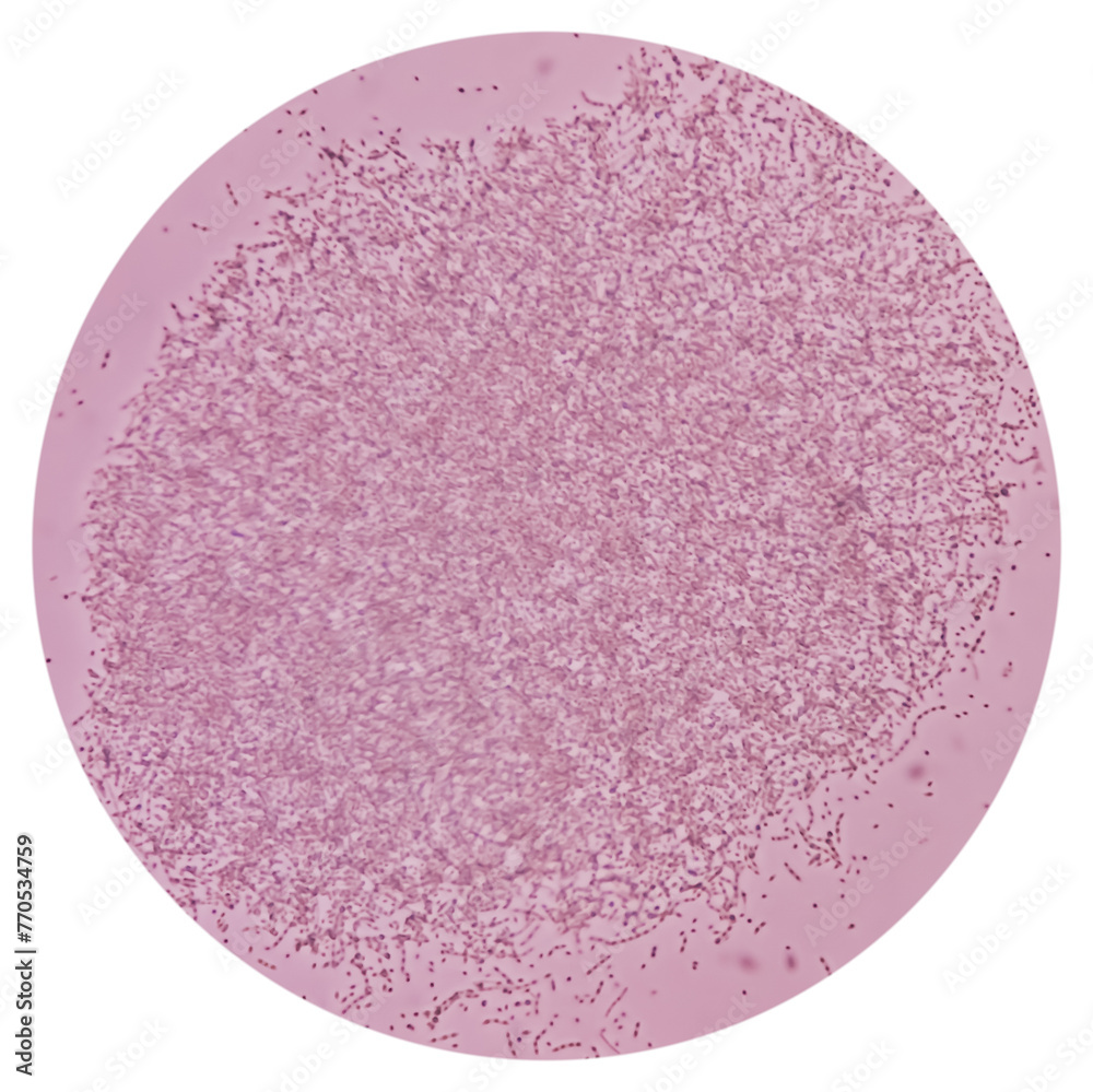 Microscopic image from fungus colonies at Sabouraud Dextrose Agar (SDA ...