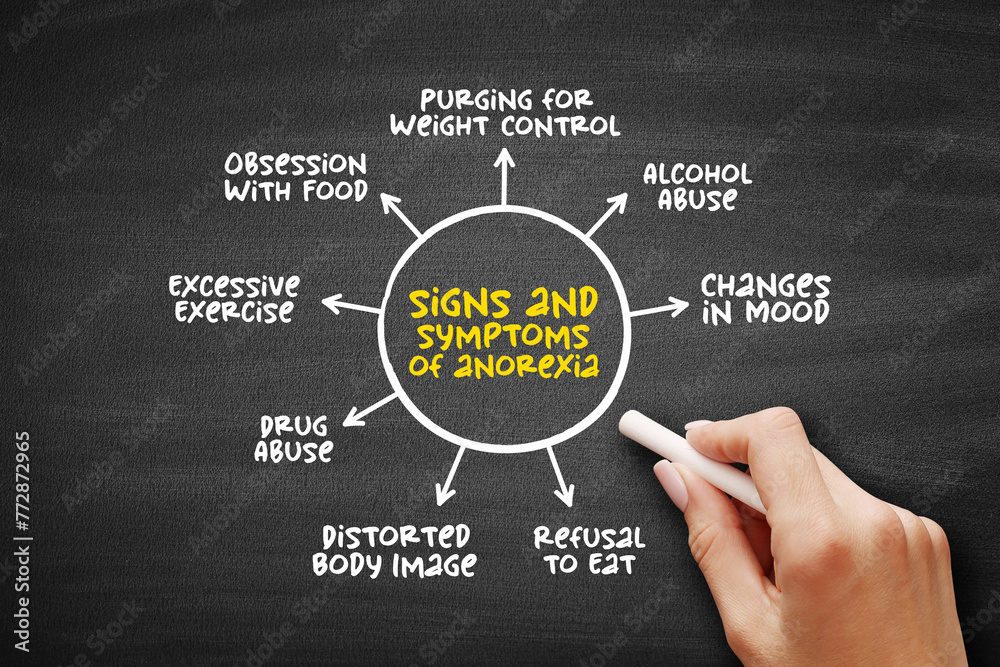 Signs and symptoms of Anorexia (eating disorder and serious mental ...