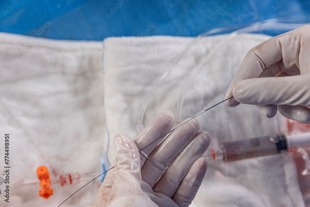 Interventional cardiology. Surgeon doctor at operation. Stent and ...