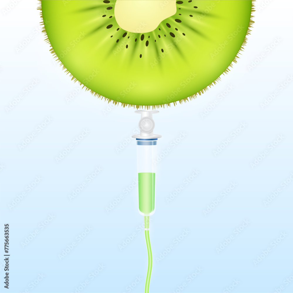 Saline line and syringe is connected to the fresh kiwi slice. IV ...