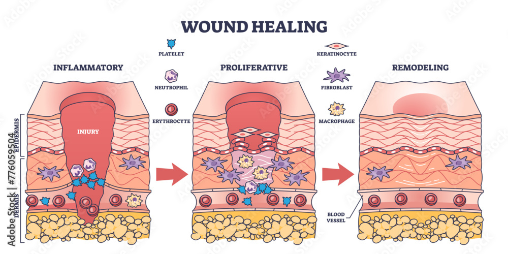Process of wound healing and anatomical body injury repair outline ...