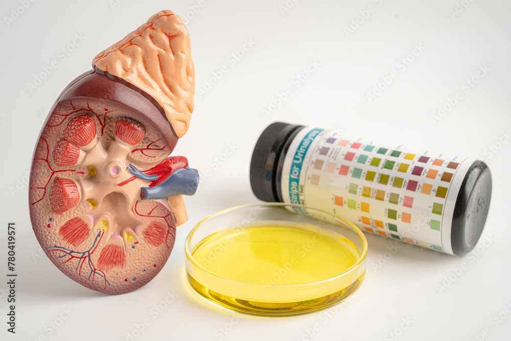 Urinalysis, Kidney model and urine cup with reagent strip pH paper test ...