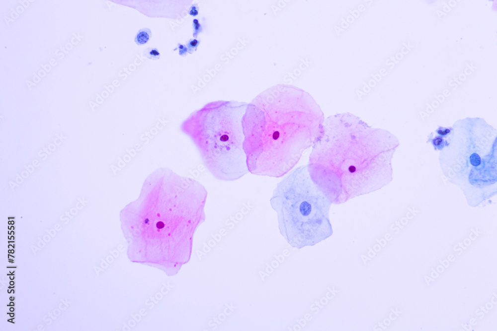 View in microscopic of human skin cells.Squamous epithelium cells ...