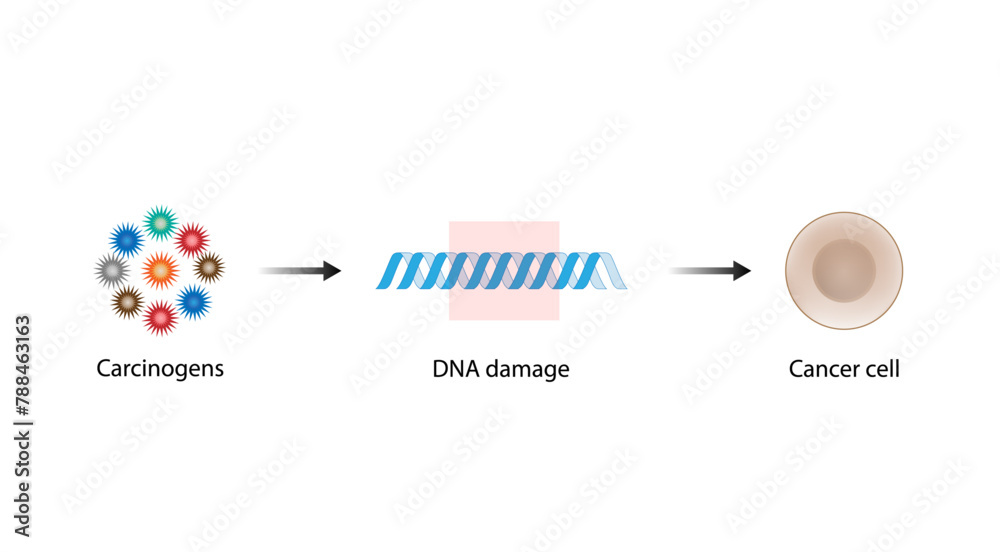 Cancer disease. Carcinogens, DNA damage. Malignant tumor. Medical ...