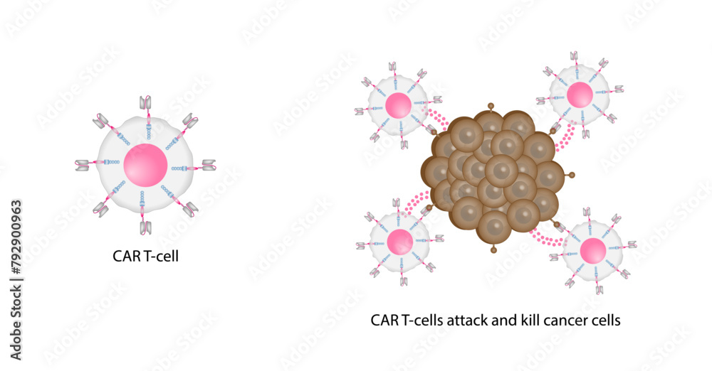 CAR T-cell therapy. Chimeric antigen receptor T cell ,CAR T cell, for ...