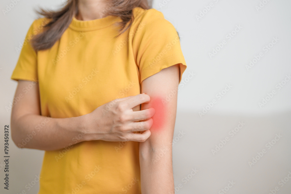 woman itching and scratching itchy arm. Sensitive Skin Allergic ...