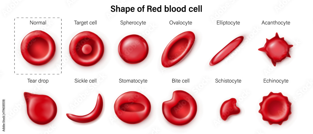 Shape variation of red blood cell morphology. Normal and abnormal ...