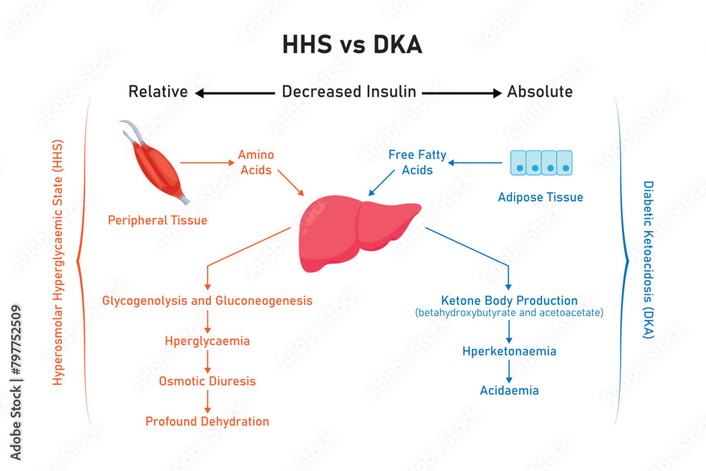 Hyperosmolar Hyperglycemic State (HHS) and Diabetic Ketoacidosis (DKA ...