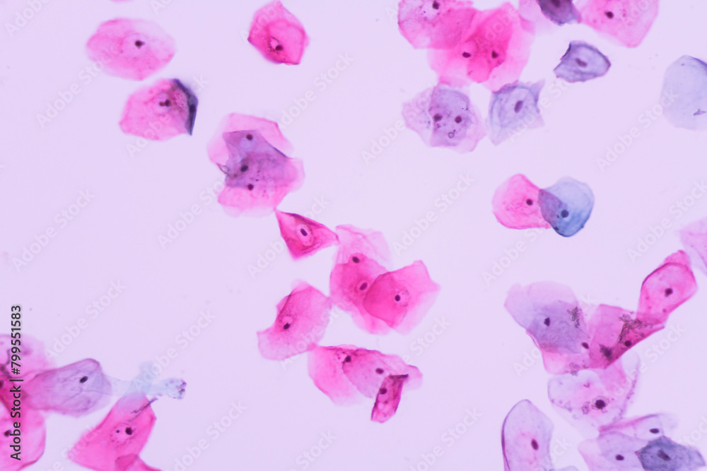 View in microscopic of human skin cells.Squamous epithelium cells ...