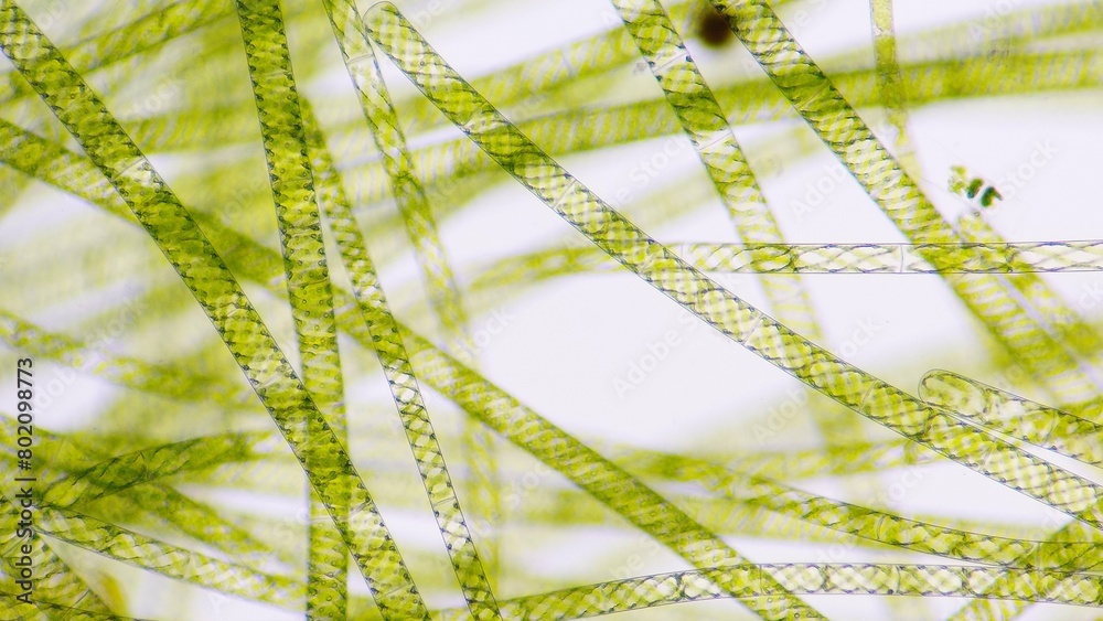 Spirogyra, a filamentous freshwater green algae with spiral arrangement ...