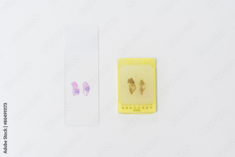 Paraffin box human tissue and glasse slide Hemotoxylin and Eosin stain ...