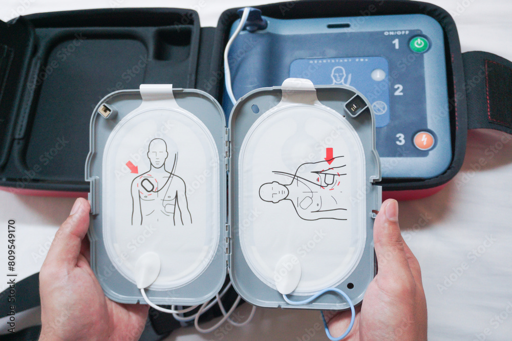 Foto de Stock Automatic external defibrillator. Portable defibrillator ...