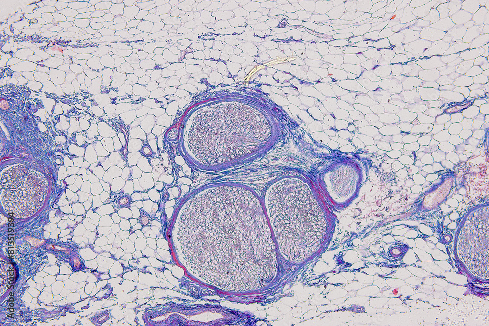 Histological Brain of mouse, Cerebellum, Sympathetic ganglion And ...