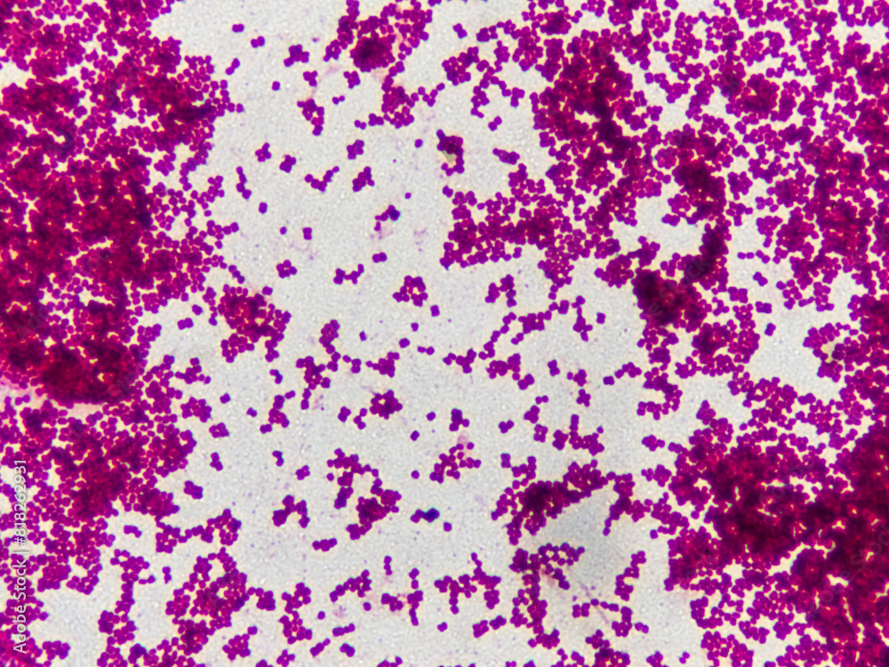Large groups of red bacterial cells on a fixed preparation under a ...