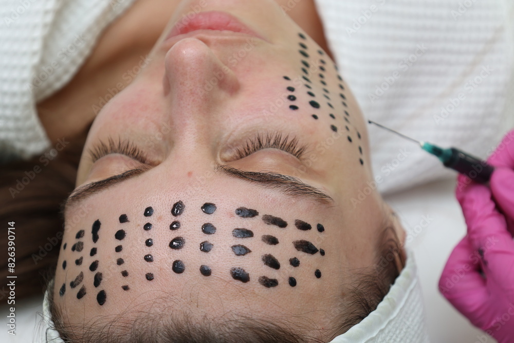 Beauty Injection. Beautiful Woman's Face With black Points On Skin ...