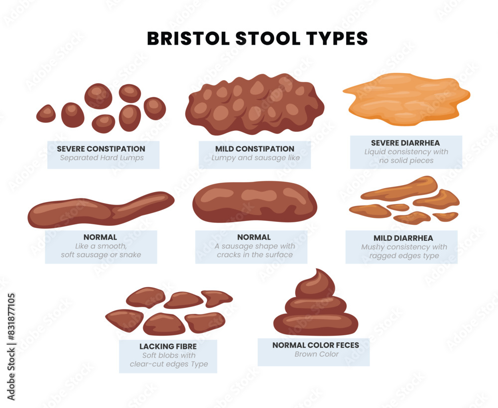 Set of various types human feces - constipation, normal and diarrhea ...