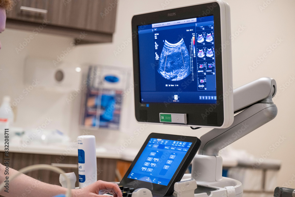 An ultrasound machine with a live scan displayed on the monitor in a ...