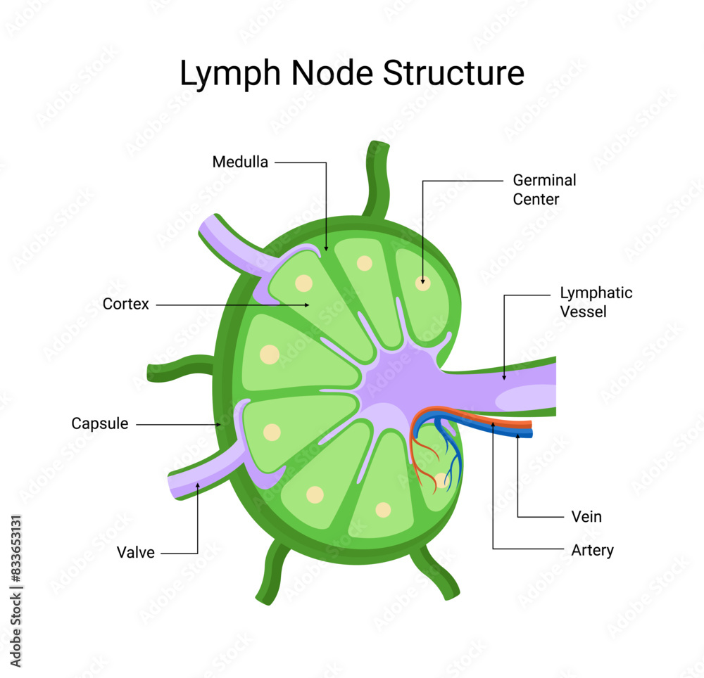 Structure of lymph node diseases Stock Vector | Adobe Stock