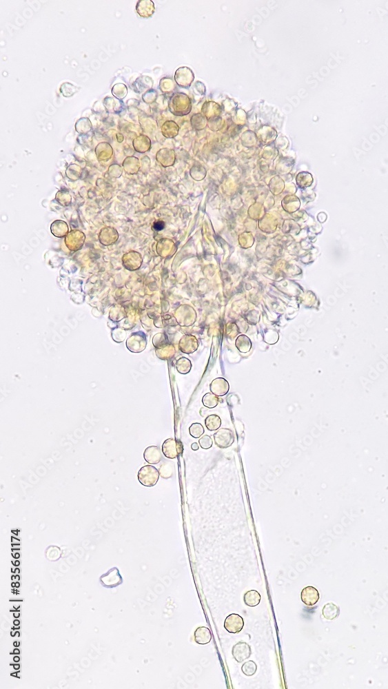 Mold species (Aspergillus sp) under microscope. Fresh sample whithout ...