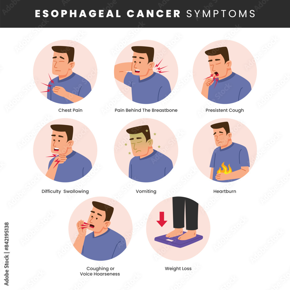 Acid Reflux Disease (GERD) or Heartburn symptoms infographic medical ...