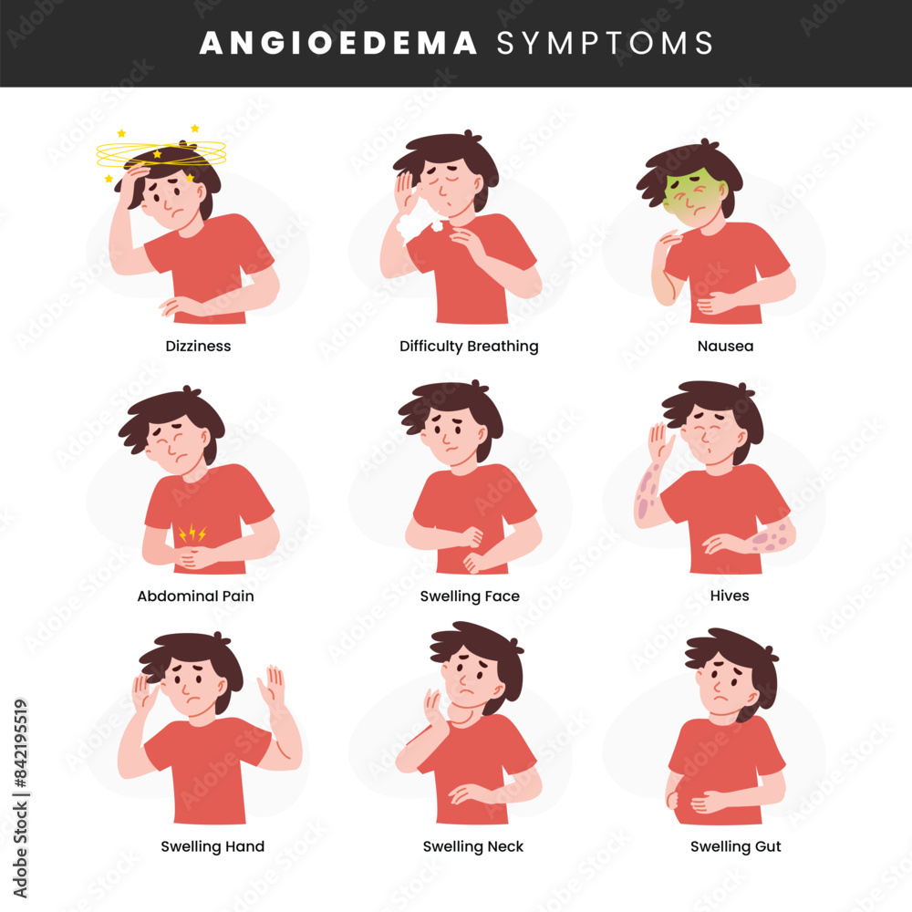 Angioedema symptoms infographic medical poster design, labeled man ...
