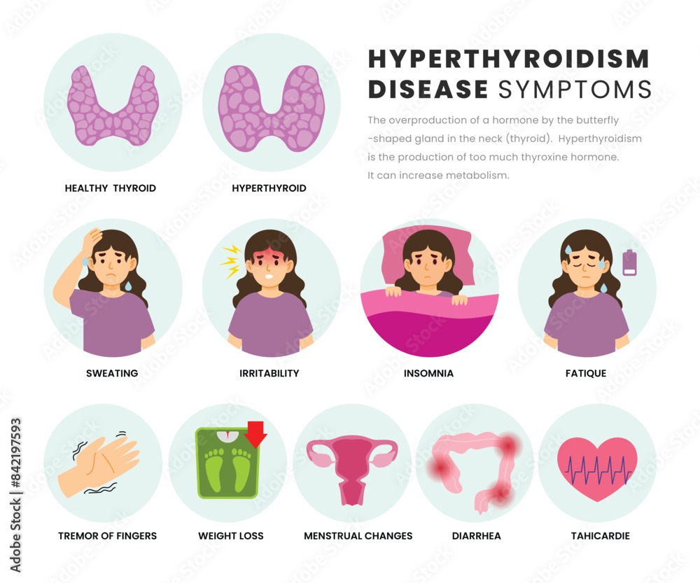 Hyperthyroidism symptoms infographic medical poster design, labeled ...