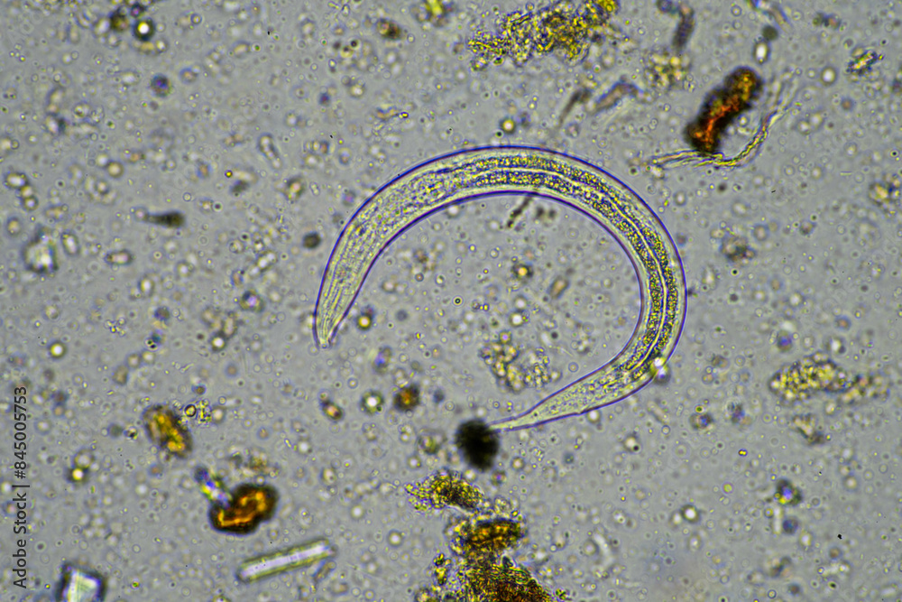 soil microorganisms under a microscope including amoeba, flagellates ...