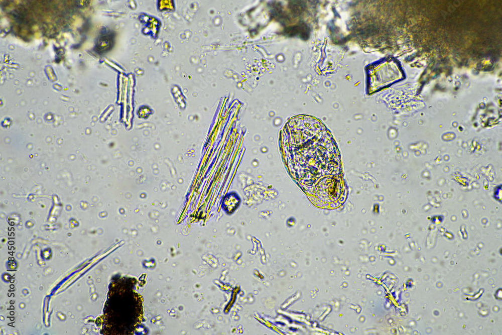 soil microorganisms under a microscope including amoeba, flagellates ...