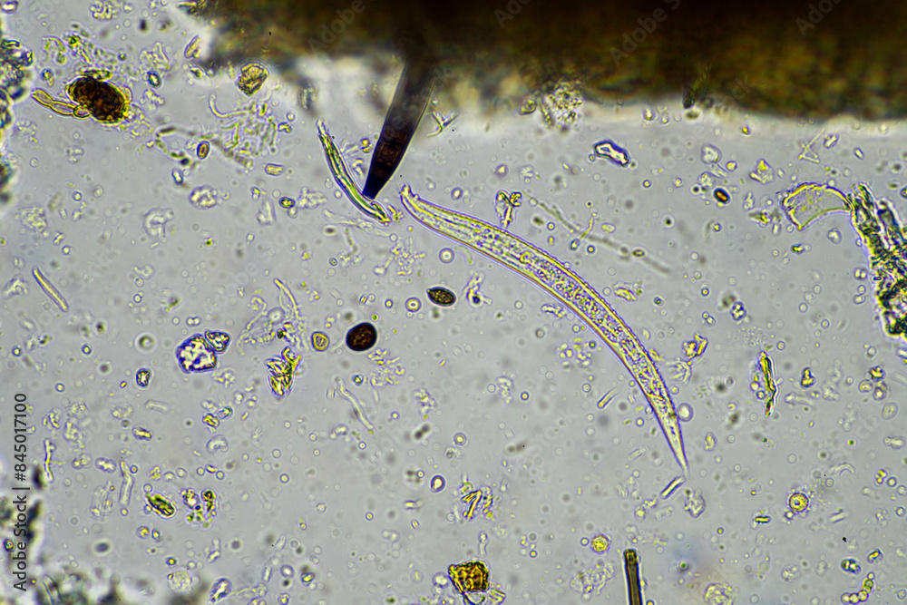 Foto de Stock microorganisms under a microscope including amoeba ...